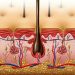 Damaged Hair Follicles - Causes, Symptoms & Treatment Options ...